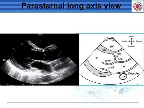Standard Imaging Of Transthoracic Echocardiography Terminology A