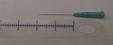 Estimation Of Bony Orbit Depth For Optimal Selection Of The Dermatologic Surgery