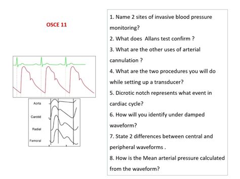Osce Anaesthesia News