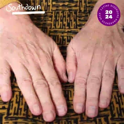 Southdown On Linkedin Learning To Love Yourself A Southdown