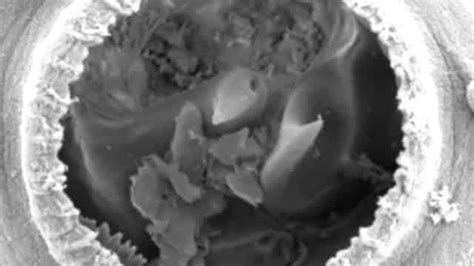 Recombinant DNA Technology Definition Steps Applications