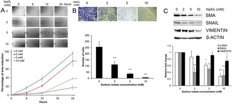 The Effect Of Sodium Iodate On Rpe Cell Migration A Arpe 19 Cell