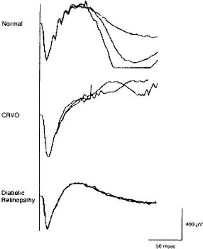 Visual Function Testing Clinical Correlations Ento Key