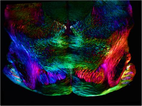 Polarization Polychromatic Image Of Mouse Brain Slice The Picture