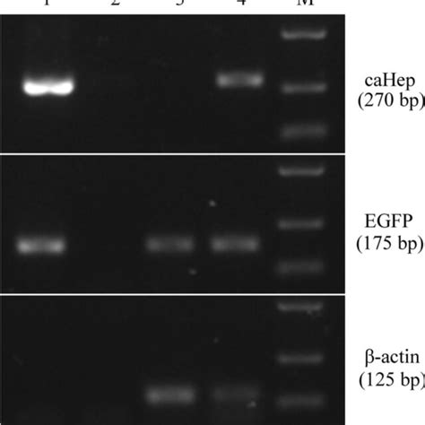 Rt Pcr Analysis Of Cahep And Egfp Mrna Expressions In Transfected