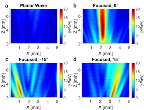 An Integrated 2d Ultrasound Phased Array Transmitter In Cmos With Pixel Pitch Matched Beamforming