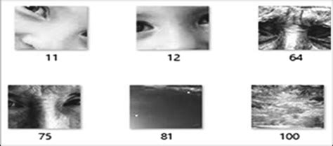 Sample Results For Mis Detection Download Scientific Diagram