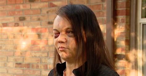 Trans Woman Viciously Beat By Mob Shouting Slurs She No Longer Feels