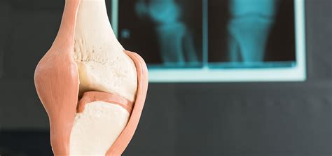 Konservative Orthopädie – OA Dr. Bernhard Schauer