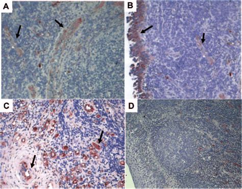 In Vivo Expression Of Cxcl12 Immunohistochemical Staining Was