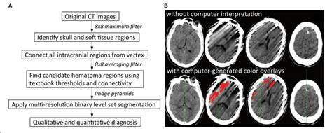 Rule Based Algorithms A Illustrates One Possible Workflow For A