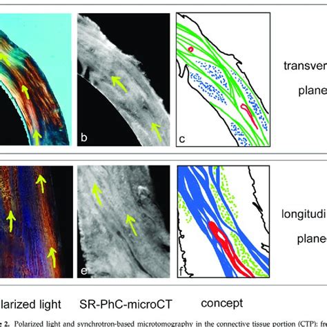 Synchrotron Radiation Based Phase Contrast Microtomography In The