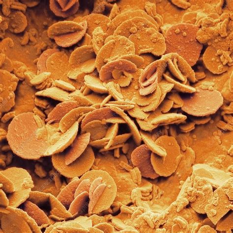Rust Sem Stock Image C033 3320 Science Photo Library