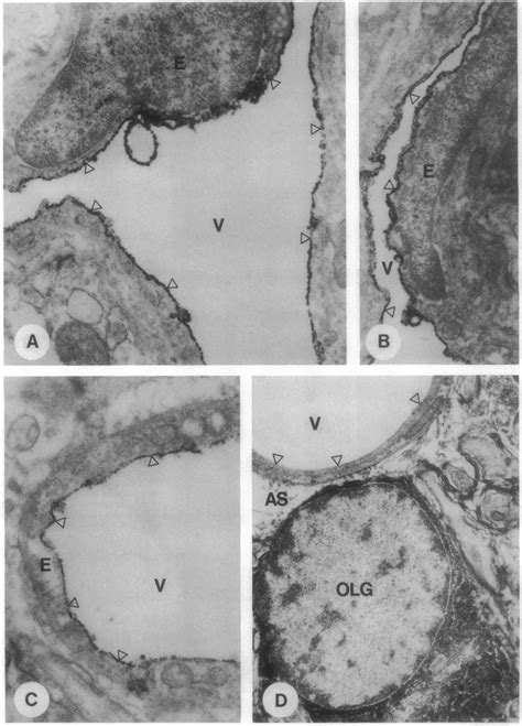 A C Electron Micrograph Of Cerebral Cortex Immunolabeled For CA IV