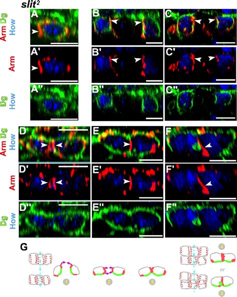 Figure 5 From Genetic Control Of Cell Morphogenesis During Drosophila