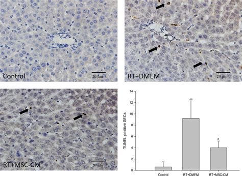 Effect Of Msc Cm Pretreatment On Radiation Induced Sec Apoptosis In Rat