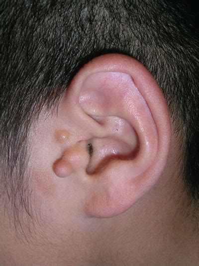 Gross Skin Growths