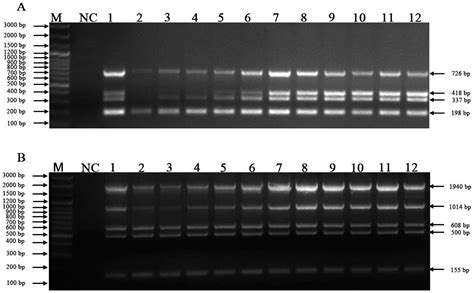 Two Multiplex Pcr Methods For Detecting Several Pathogens Associated With Feline Respiratory And