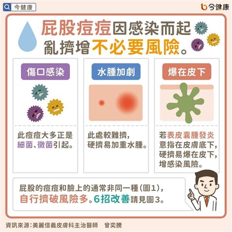 屁股痘痘「亂擠3下場」！醫警告：和臉上的不一樣 胖子容易長 Ettoday健康雲 Ettoday新聞雲
