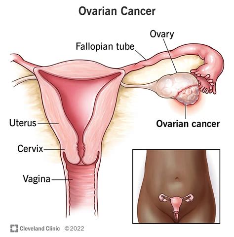 Ovaries Essential Functions And Health Tips For Women Reproductive