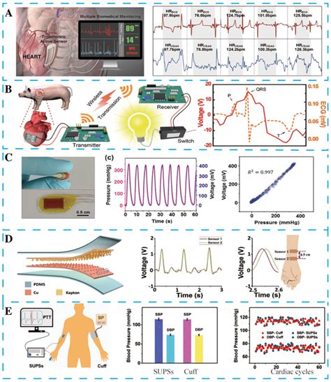 self‐powered cardiac and pulse sensors based on ngs a implantable download scientific