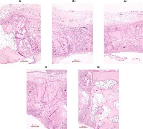 A E Photomicrograph Of Bony Defect Grafted With Quercetin In
