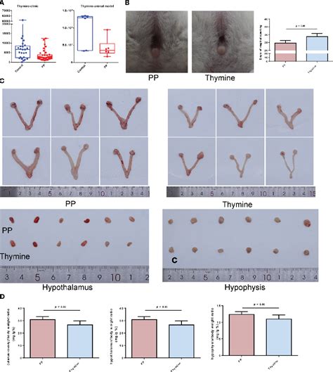 Figure From Multi Omic Analysis Of Precocious Puberty Girls Pathway Changes And Metabolite