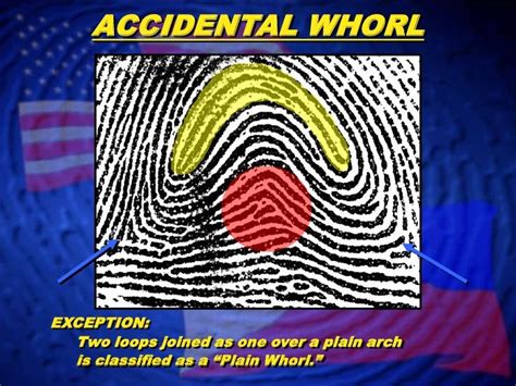 Whorl Patterns