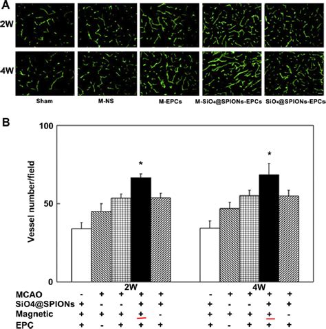 Angiogenesis Increased In M Sio 4 Spions Epcs Treated Mice A The
