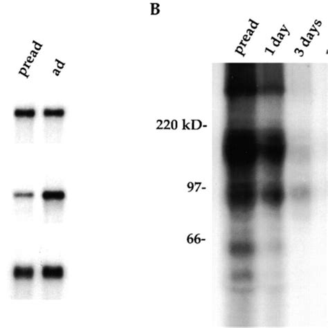 Tgf β Receptor Expression During Adipocyte Differentiation Of 3t3 F442a