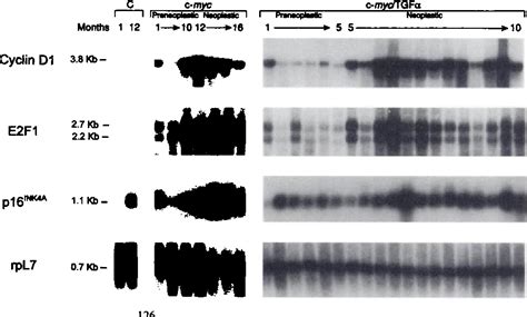 Figure 1 From Disruption Of The Prb E 2 F Pathway And Inhibition Of Apoptosis Are Major