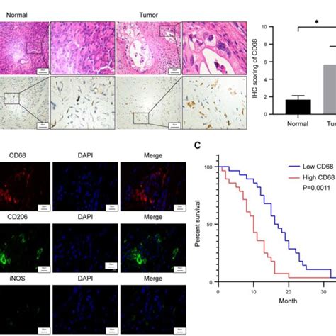 Tumor Associated Macrophage Tam Density Correlates With Survival