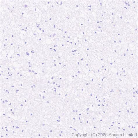 兔specific Ihc Polymer Detection试剂盒hrp Dab Ab209101 Abcam中文官网