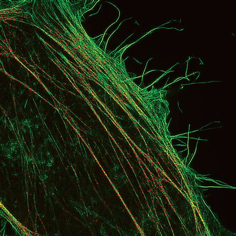 Super Resolution Microscopy Comes Into Focus