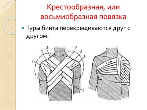 Технологии наложения повязок - online presentation