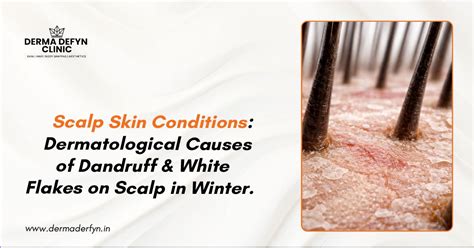 Scalp Skin Conditions And Disorders Derma Defyn Clinic