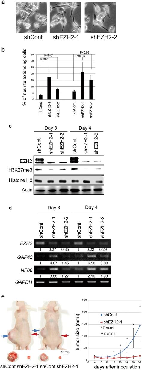 Knockdown Of Ezh2 Promotes Neurite Extension And Induces Neuronal