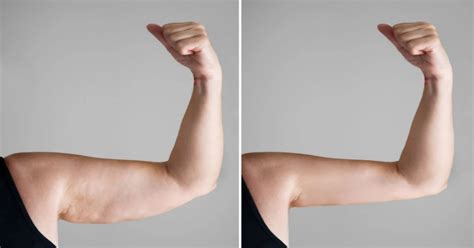 How To Lose Flabby Arms Fat In 4 Weeks With These Workouts