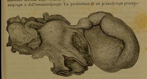 This Image Is Taken From Page Of Patologia E Terapia D Flickr
