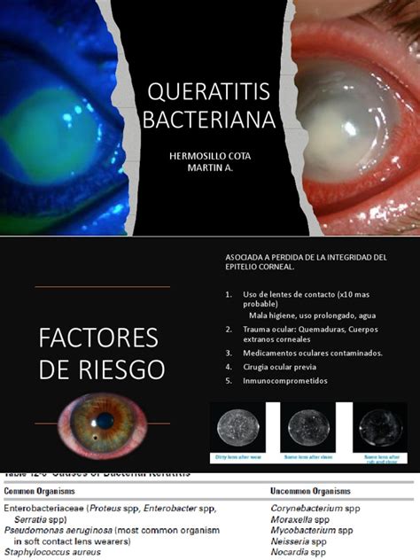 Queratitis Pdf Córnea Ojo Humano