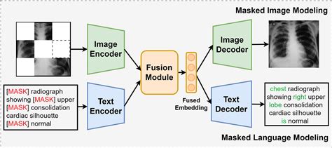 Fine Tuning A Vision Language Model For Classifying Chest X Ray