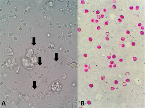 Cryptosporidium Spp Saiba Mais Sobre Ele Sbs