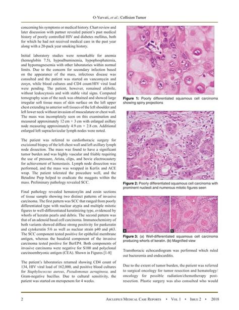 Collision Tumor Of The Thorax Pdf