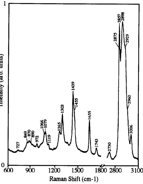 Near Ir Raman Spectrum Of Normal Breast Specimen Excited By