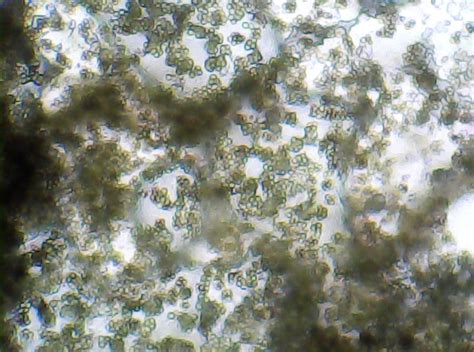 Mold Photos Teach Yourself Environmental Home Inspecting