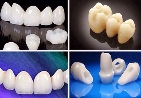 Laser Dentistry Cluj Cabinet Stomatologie Asistata Laser Dr Mirela