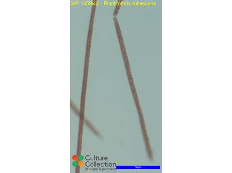 Planktothrix Rubescens