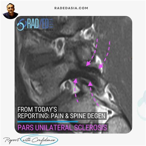 Radiology Radiologist Radiologia Radedasia Mri Spinemri Spinect