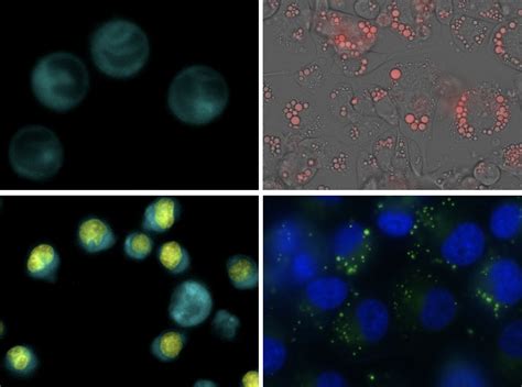 Elucidation Of The Innate Immune System As A Basis For The Development Of Novel Therapies