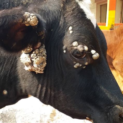 Dr Hansika Singh A Case Of Warts In A Calf Warts Are A Common Skin
